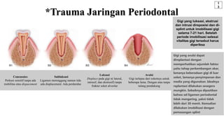 Trauma dentoalveolar | PPTX