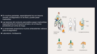 Trauma de páncreas.pptx