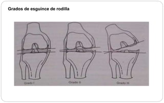 Trauma de rodilla | PPTX