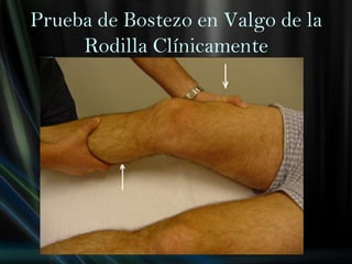 Trauma de rodilla 7ma rotacion, ortopedia, unah | PPTX