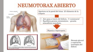 Trauma de torax | PPTX
