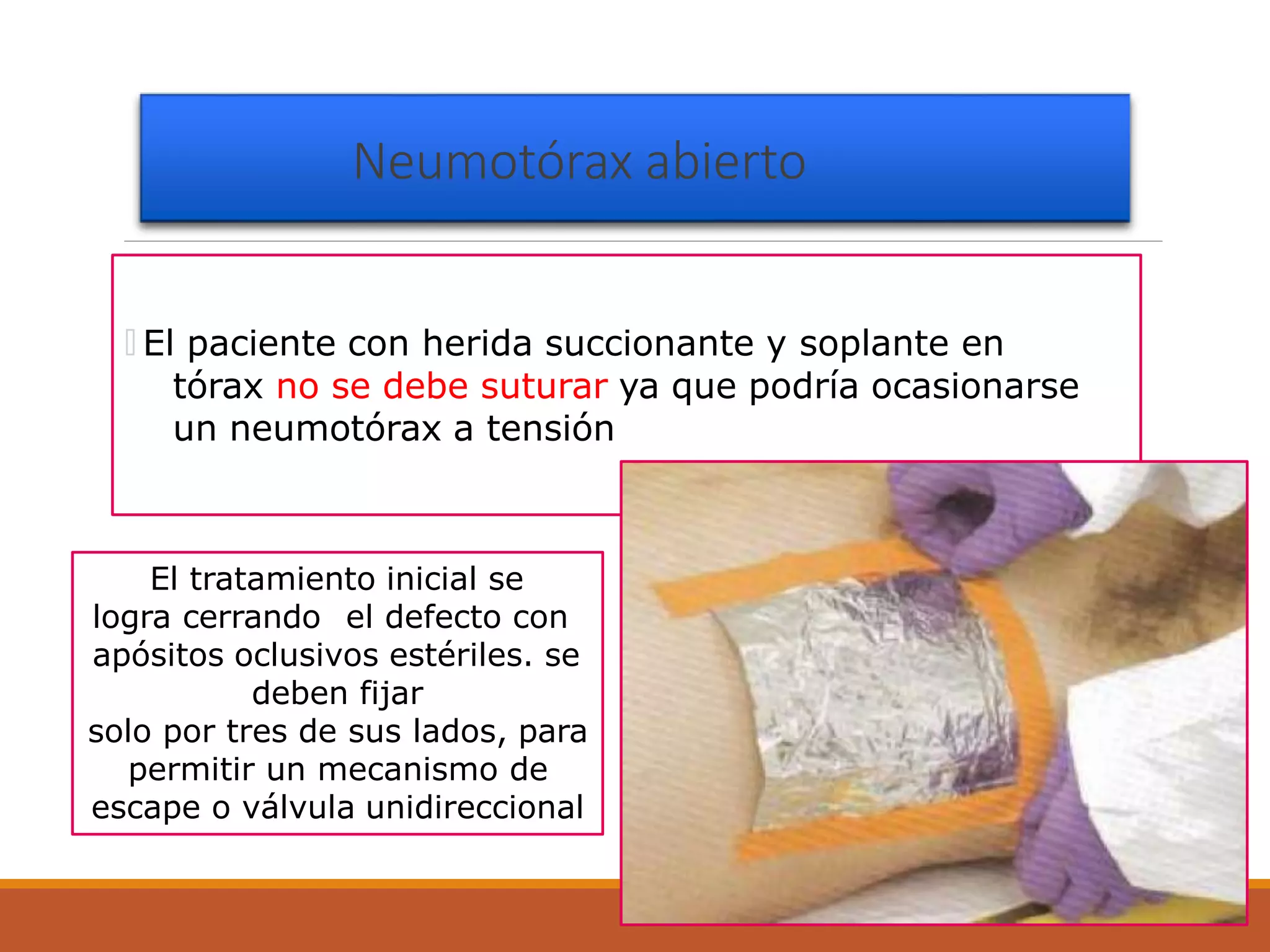 Trauma de torax | PPTX