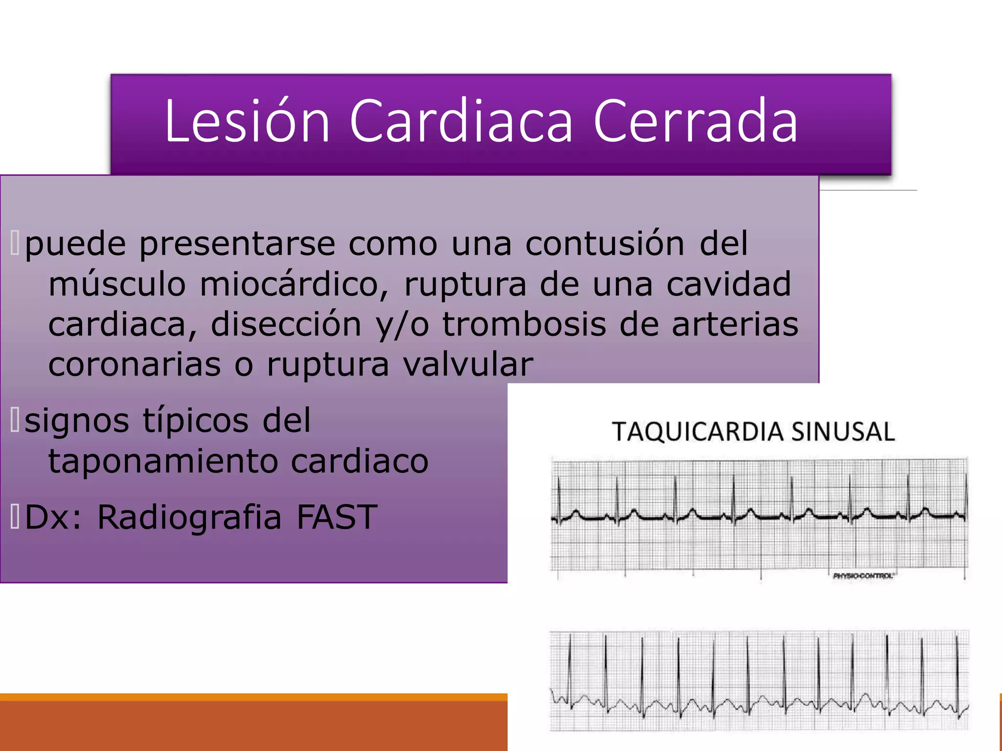 Trauma de torax | PPTX