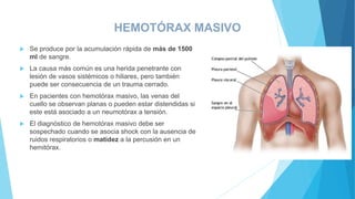 TRAUMA DE TORAX.pptx