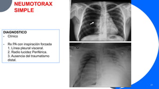 trauma de tórax - abierto/Cerrado - Tipos | PPTX