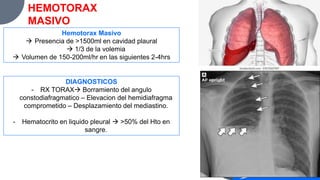 trauma de tórax - abierto/Cerrado - Tipos | PPTX