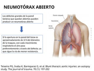 Comprehensive Overview of Thoracic Trauma: Diagnosis and Management | PPTX