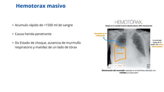TRAUMA DE TORAX | PDF