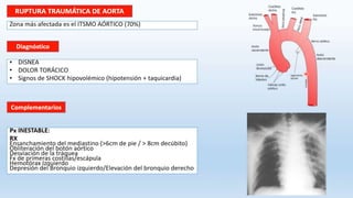 TRAUMA DE TORAX | PDF