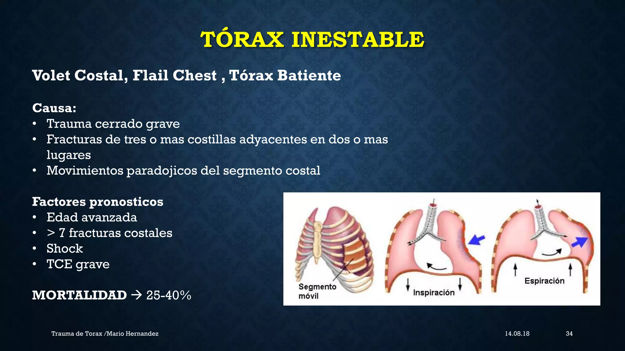 Trauma de torax 07 04-2018 | PPT