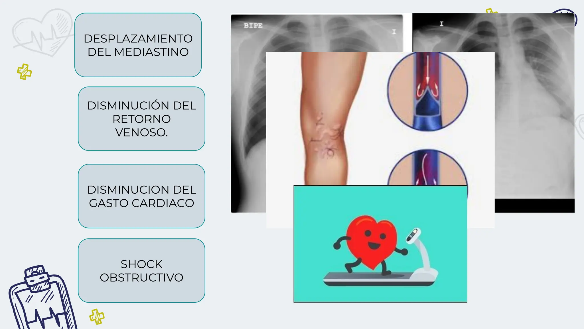 TRAUMA DE TORAX ABIERTO Y CERRADO presentación .pdf