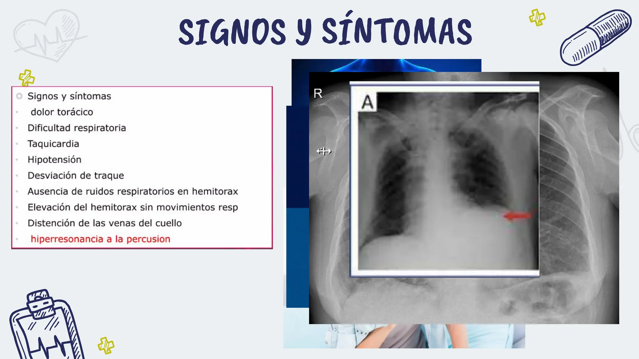 TRAUMA DE TORAX ABIERTO Y CERRADO presentación .pdf