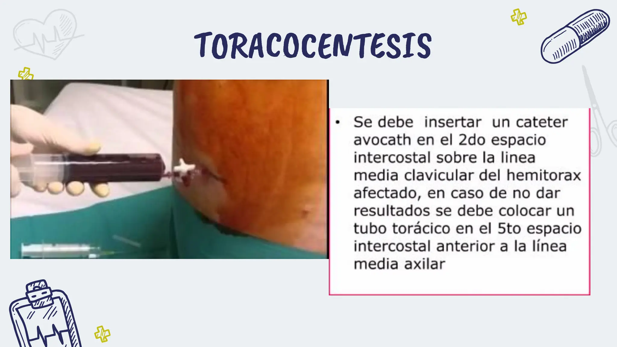 TRAUMA DE TORAX ABIERTO Y CERRADO presentación .pdf