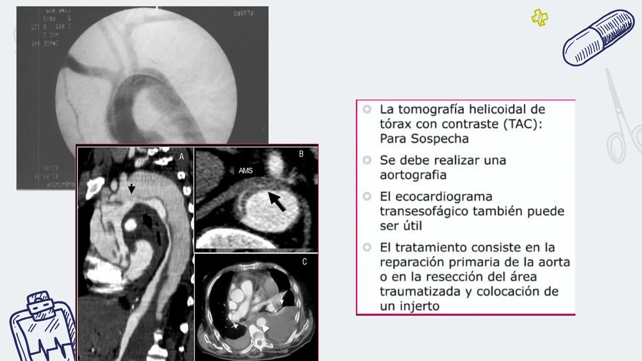 TRAUMA DE TORAX ABIERTO Y CERRADO presentación .pdf