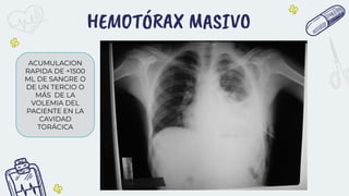 TRAUMA DE TORAX ABIERTO Y CERRADO presentación .pdf