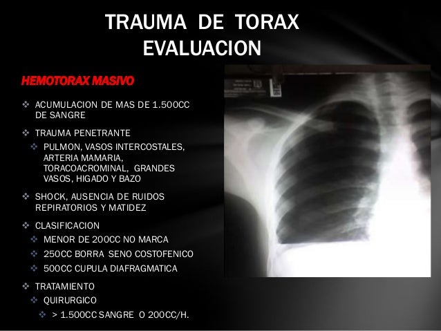 Trauma de torax