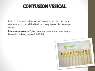 Trauma de vejiga | PPT