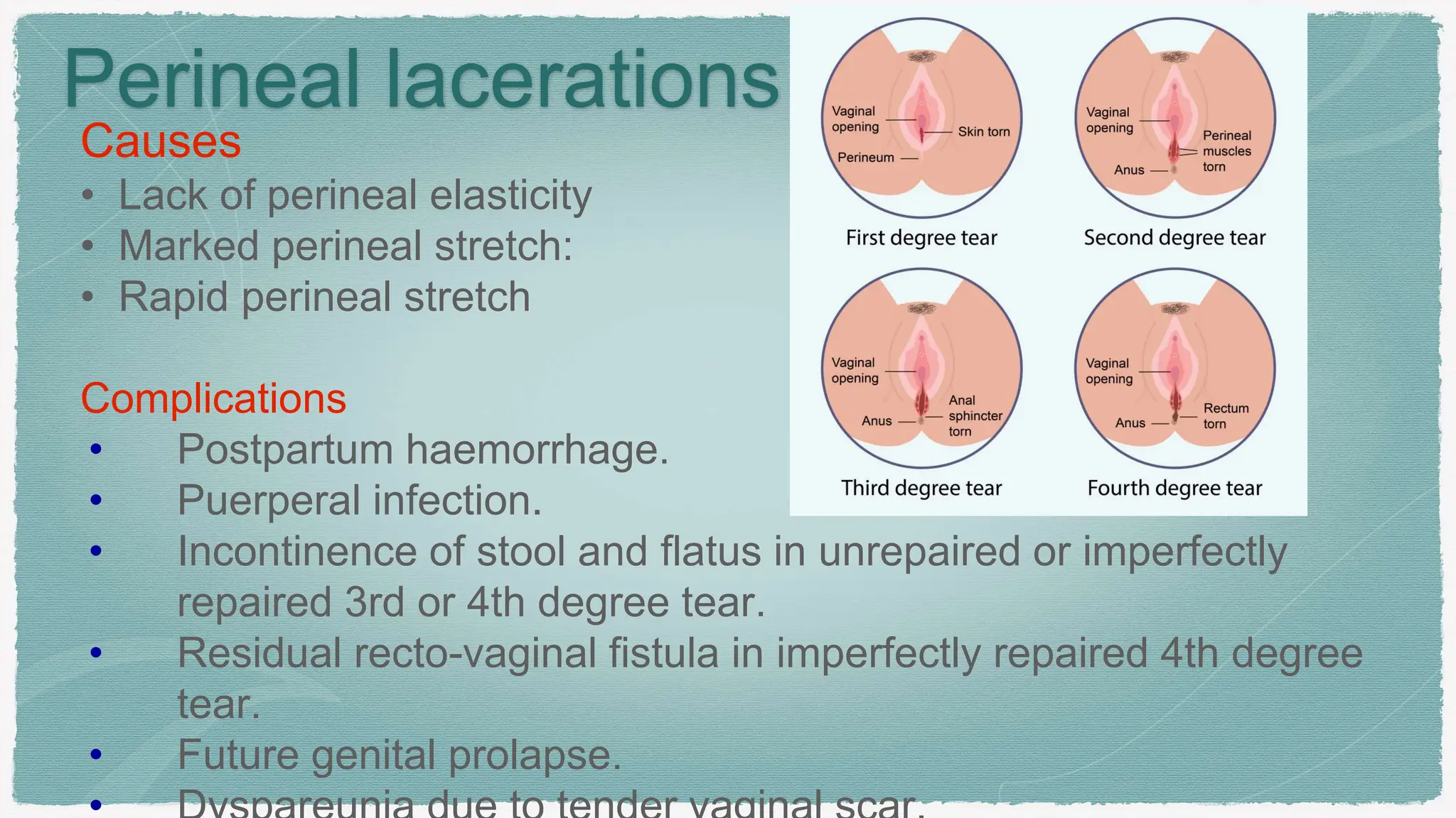 Trauma during labor Razi mohammadaxy.pptx