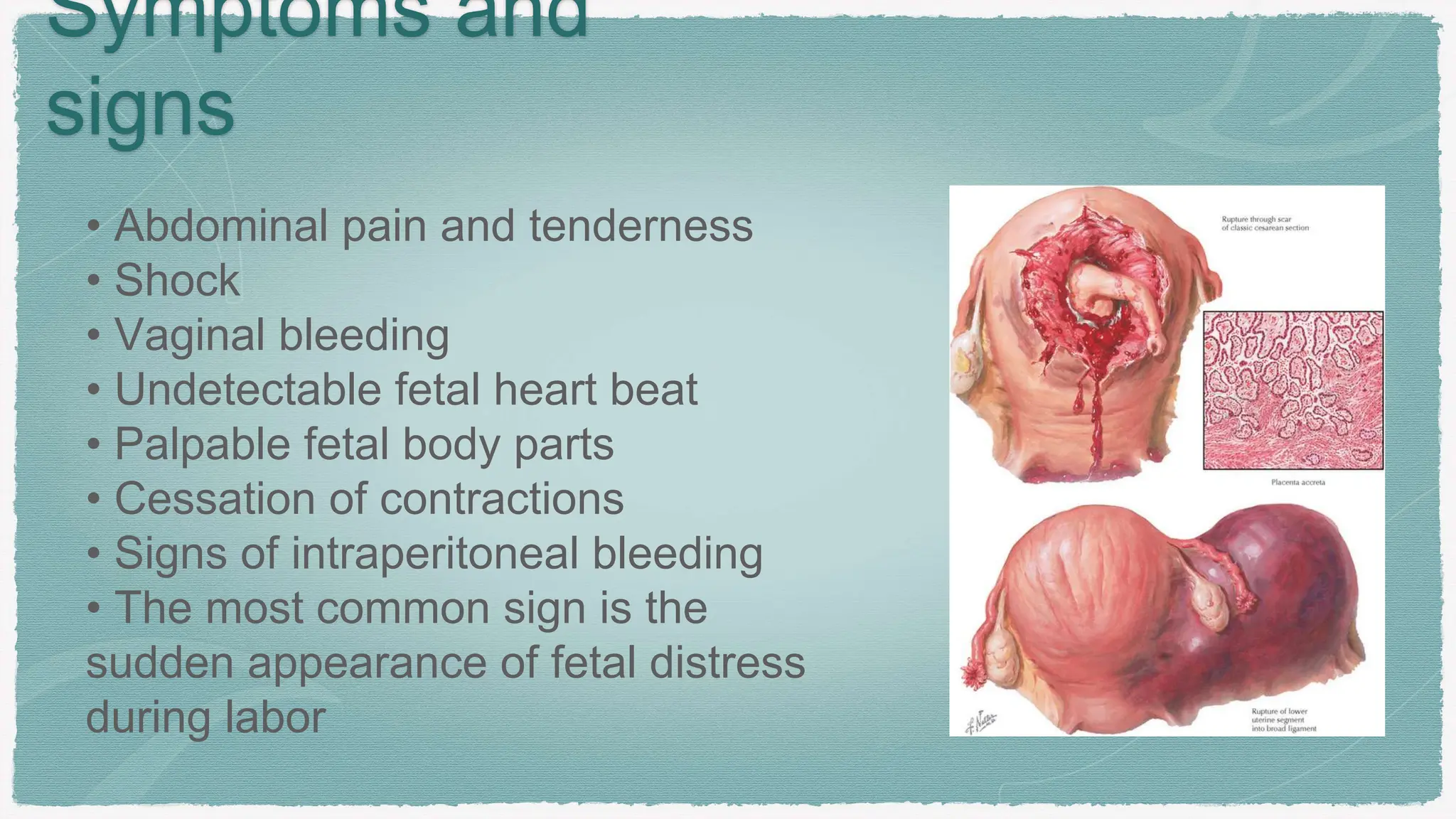 Trauma during labor Razi mohammadaxy.pptx