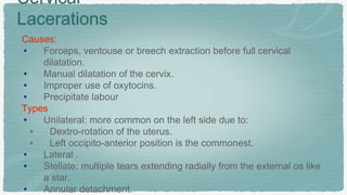 Trauma during labor Razi mohammadaxy.pptx