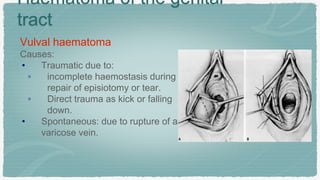Trauma during labor Razi mohammadaxy.pptx