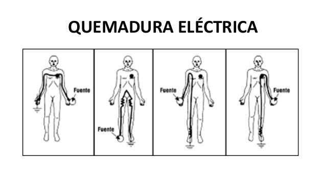 Trauma Electrico