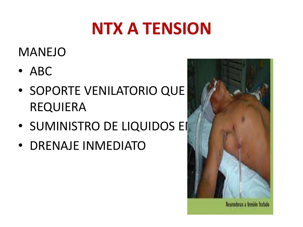 TRAUMA EN TORAX