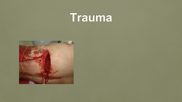 Trauma epidemiology person, place, time graph | PPT