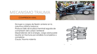 TRAUMA ESPINAL TORACOLUMBAR PEDIATRICO.pptx