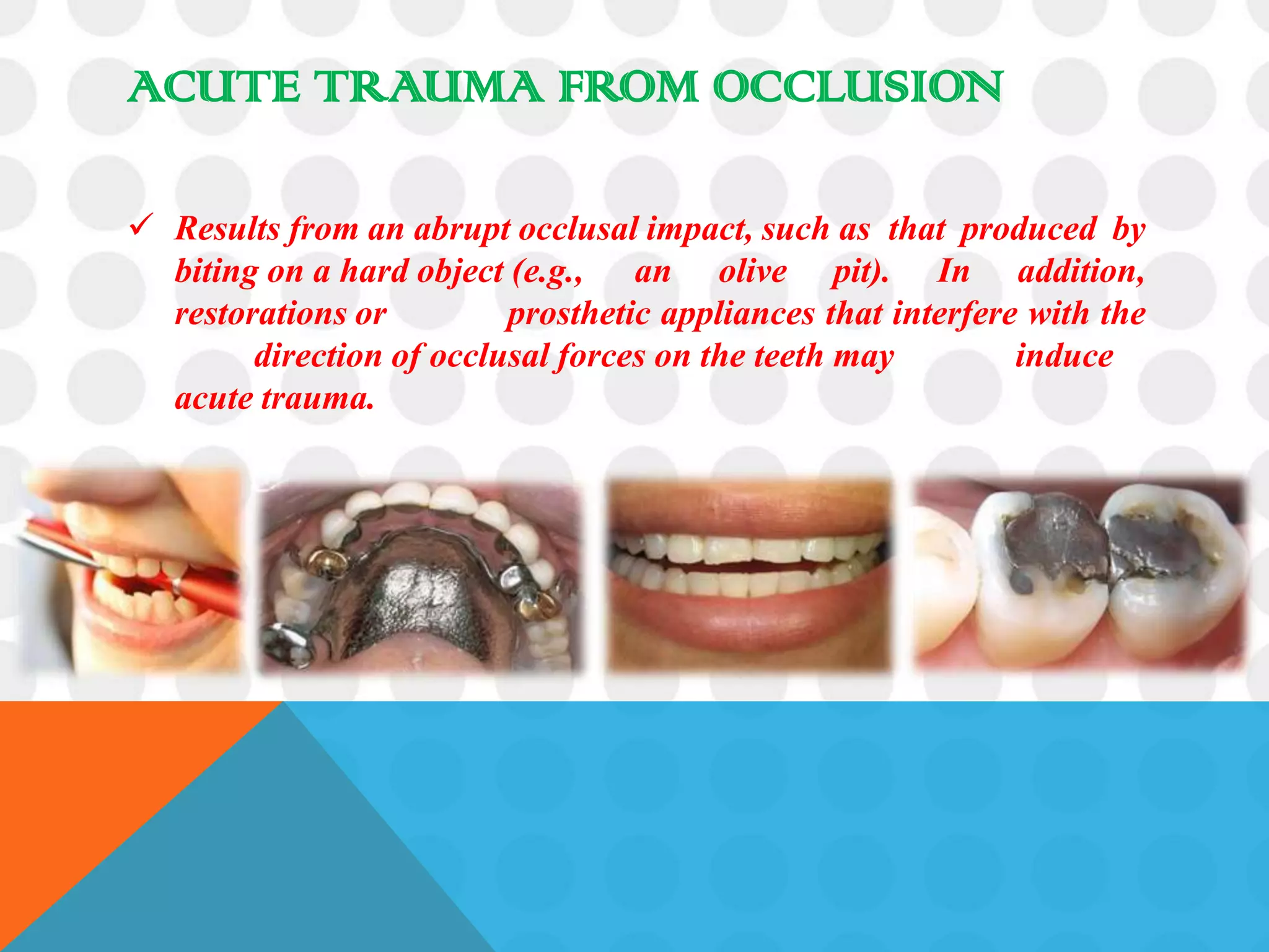 Trauma from occlusion | PPTX