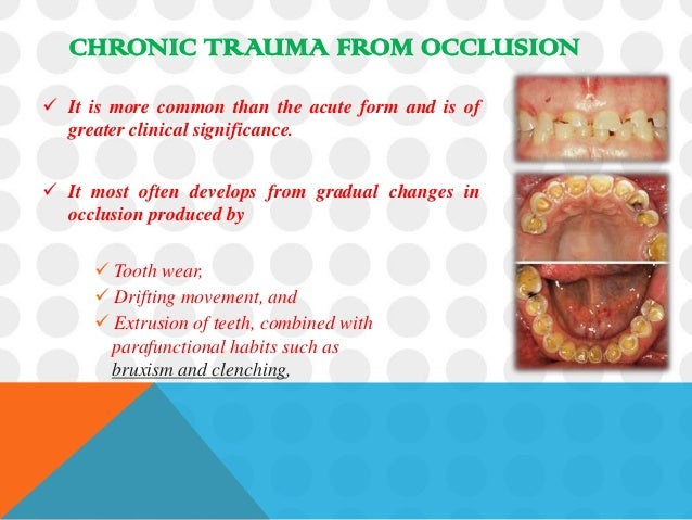 Trauma from occlusion