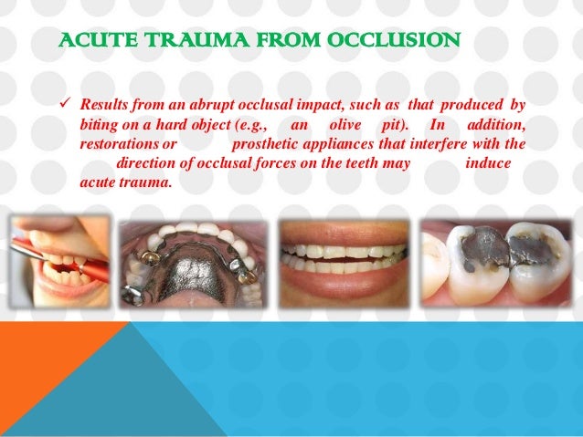 Trauma from occlusion