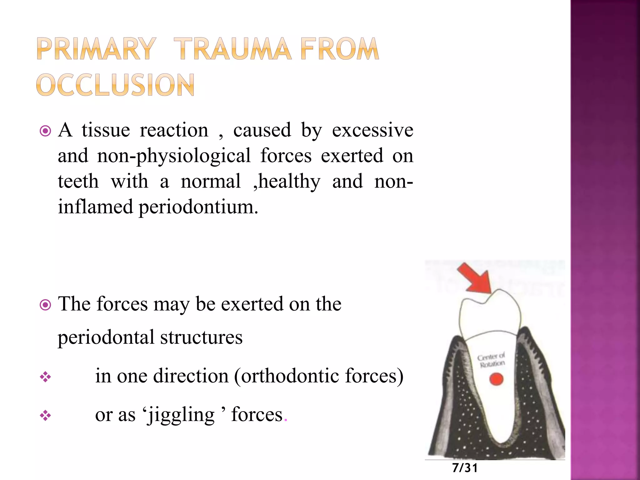 Trauma from occlusion | PPTX