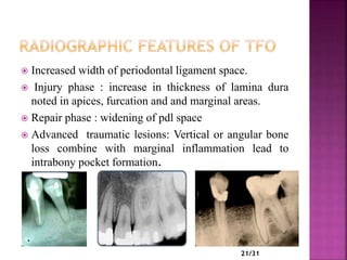 Trauma from occlusion | PPTX