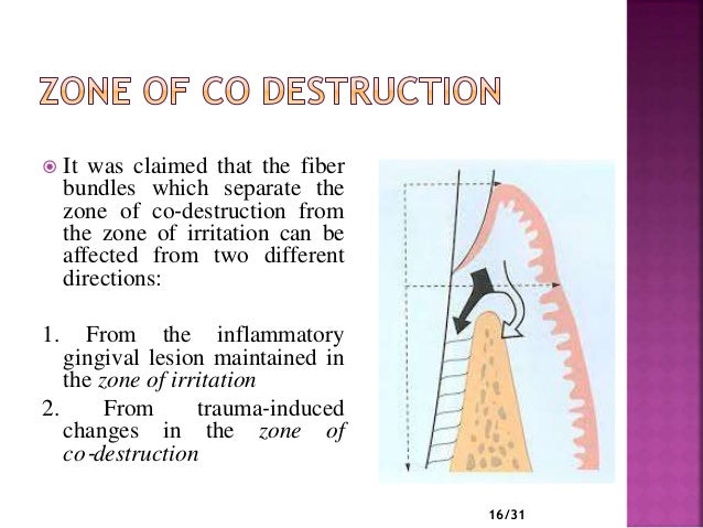 Trauma from occlusion