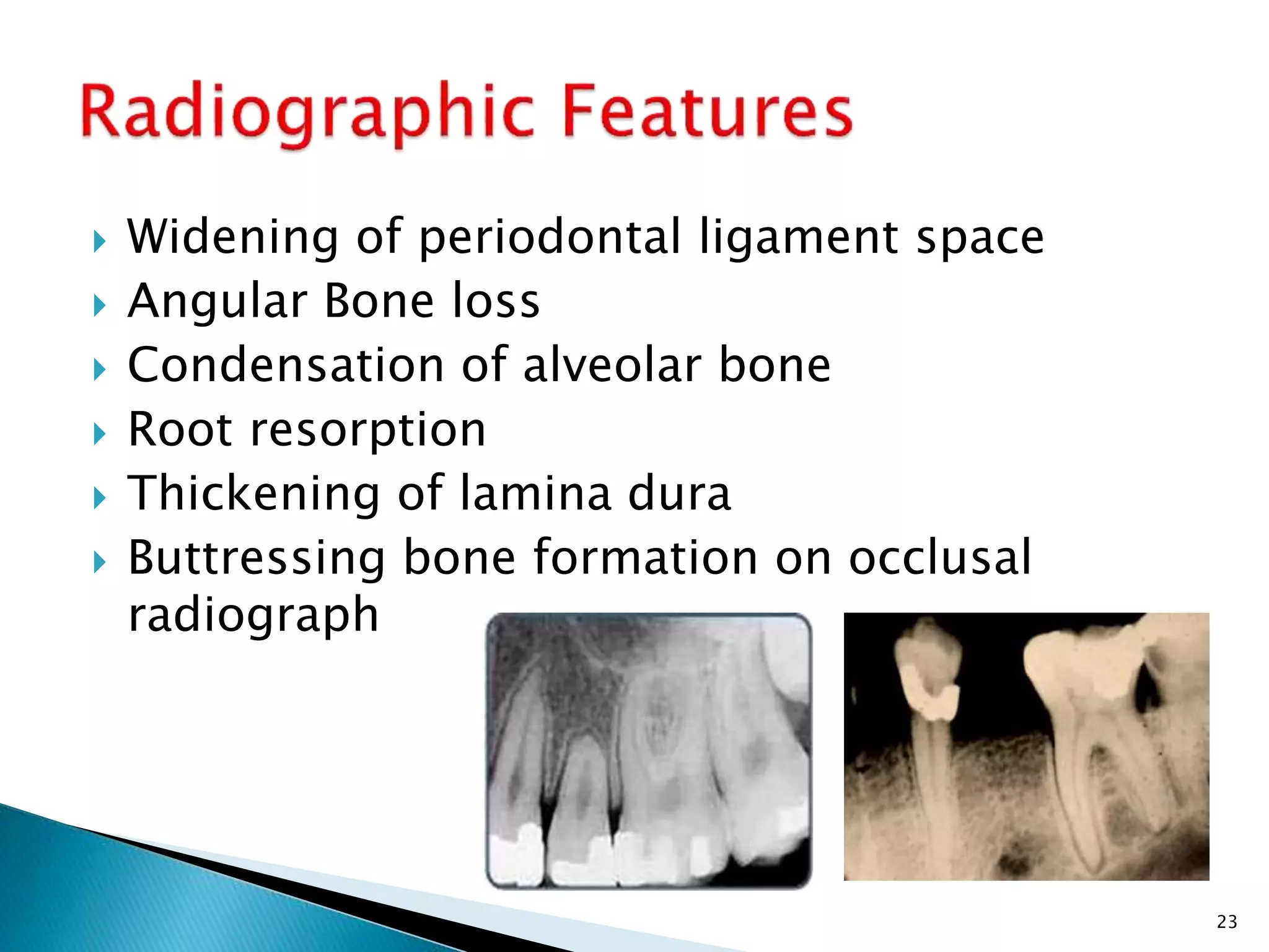 Trauma from occlusion | PPTX