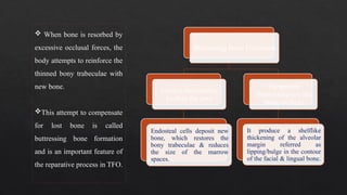 trauma from occlusion in periodontology. | PPTX