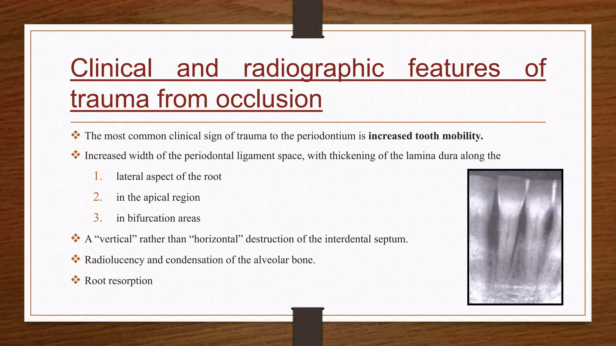 Trauma from occlusion | PPTX