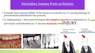 Trauma from occlusion | PPTX