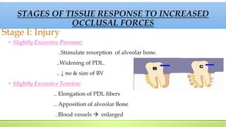 Trauma from occlusion | PPTX