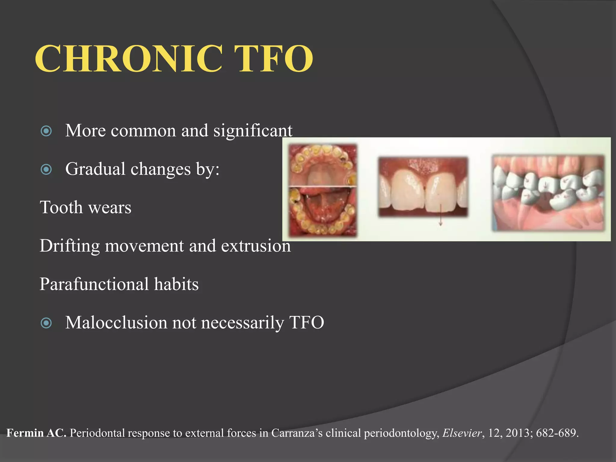 Trauma from occlusion | PPT