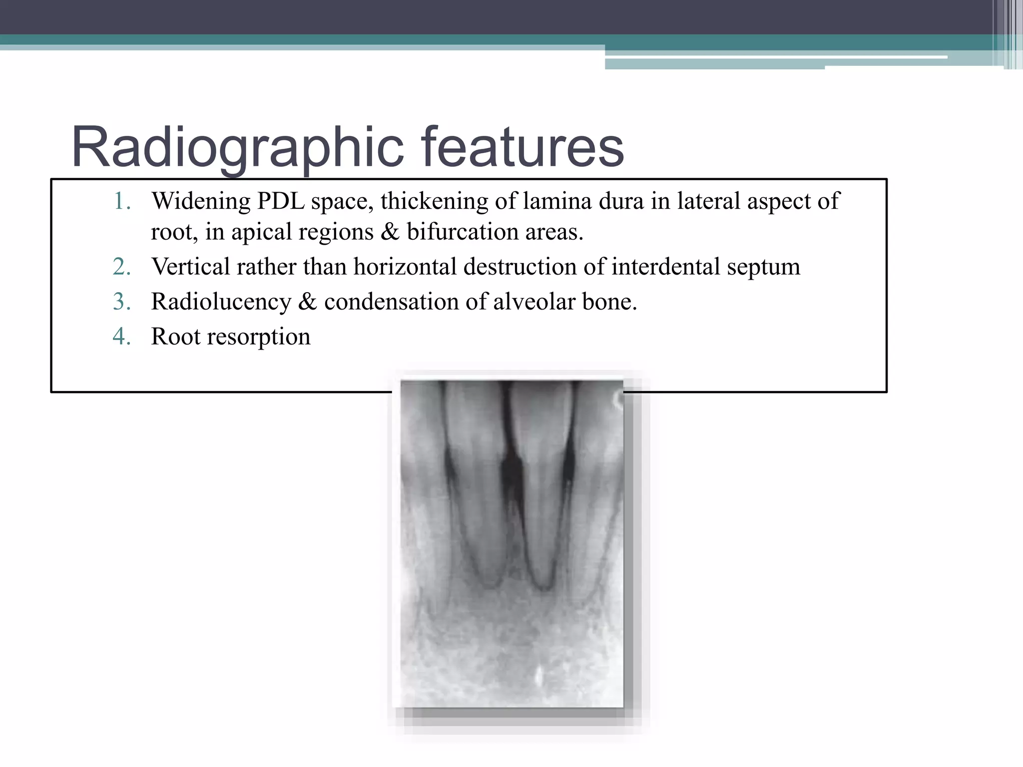 Trauma From Occlusion.pptx