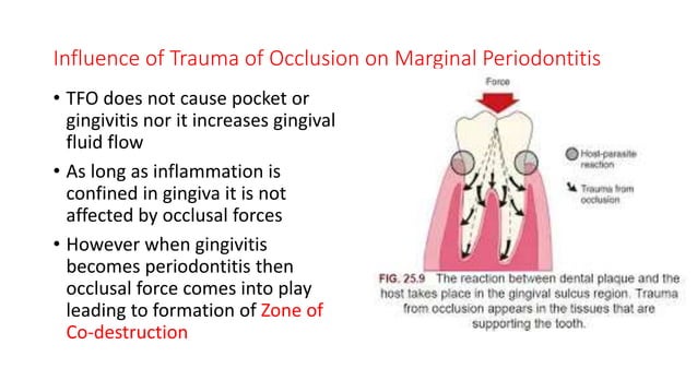 Trauma from occlusion.ppt | Dental Health | Diseases and Conditions