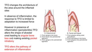 Trauma from occlusion.ppt