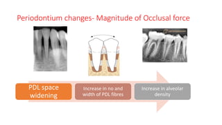 Trauma from occlusion.ppt