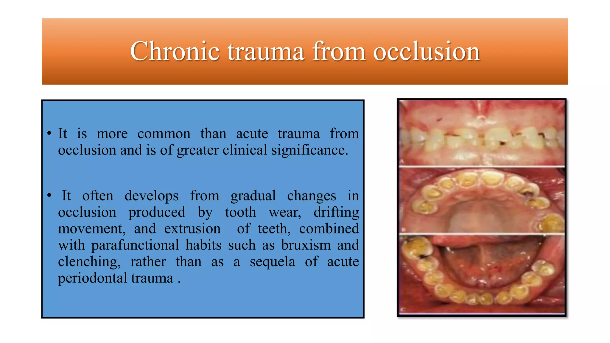 Trauma from occlusion in Periodontics.pptx