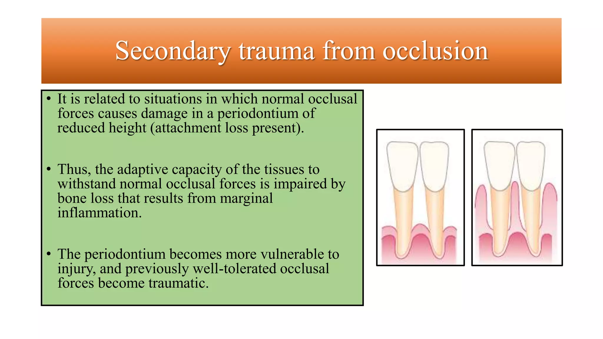 Trauma from occlusion in Periodontics.pptx