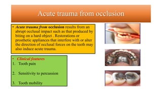 Trauma from occlusion in Periodontics.pptx