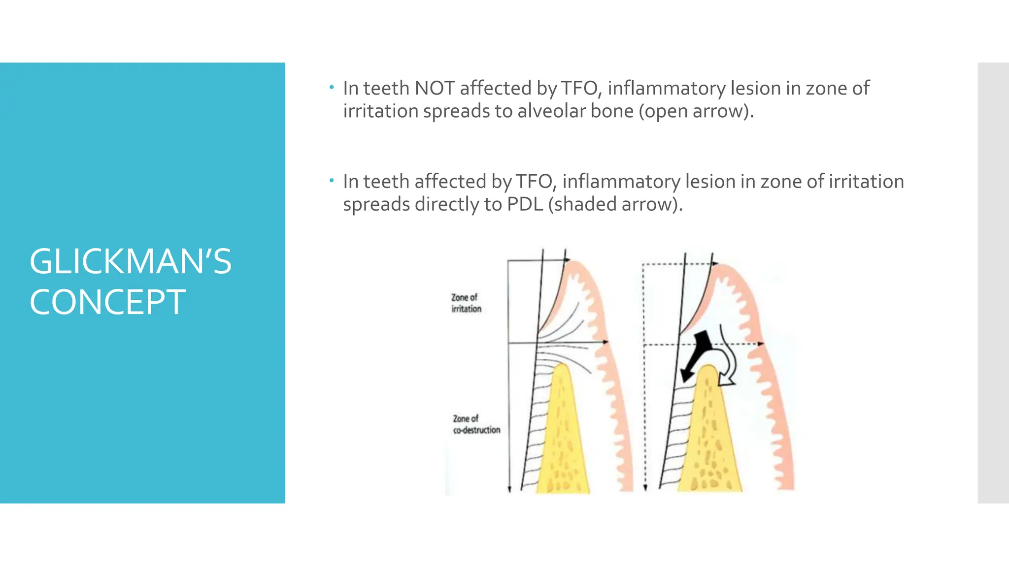 TRAUMA FROM OCCLUSION- APOORVA DHOPTE.pptx