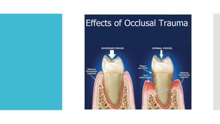TRAUMA FROM OCCLUSION- APOORVA DHOPTE.pptx